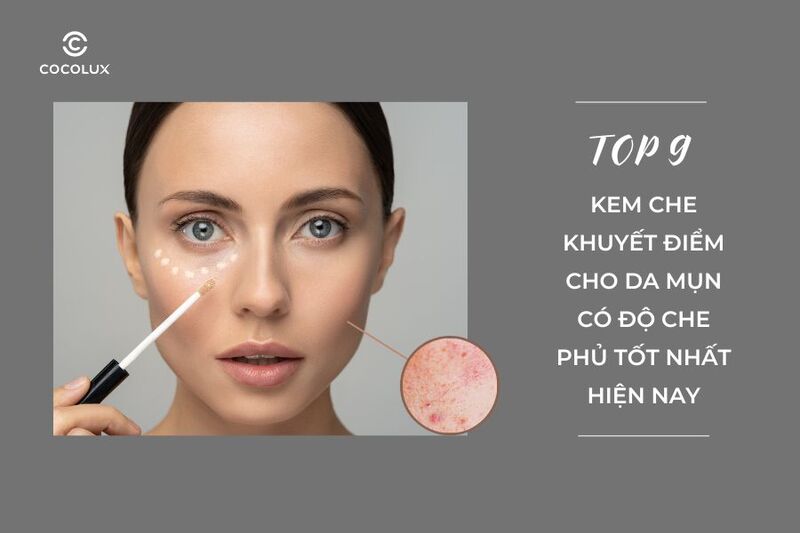 Top 9 kem che khuyết điểm cho da mụn có độ che phủ tốt nhất hiện nay